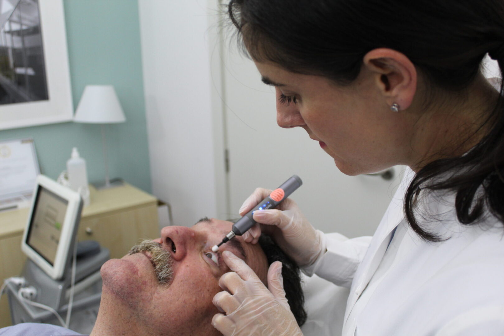 Eyelid microexfoliation: BlephEx - Miranza