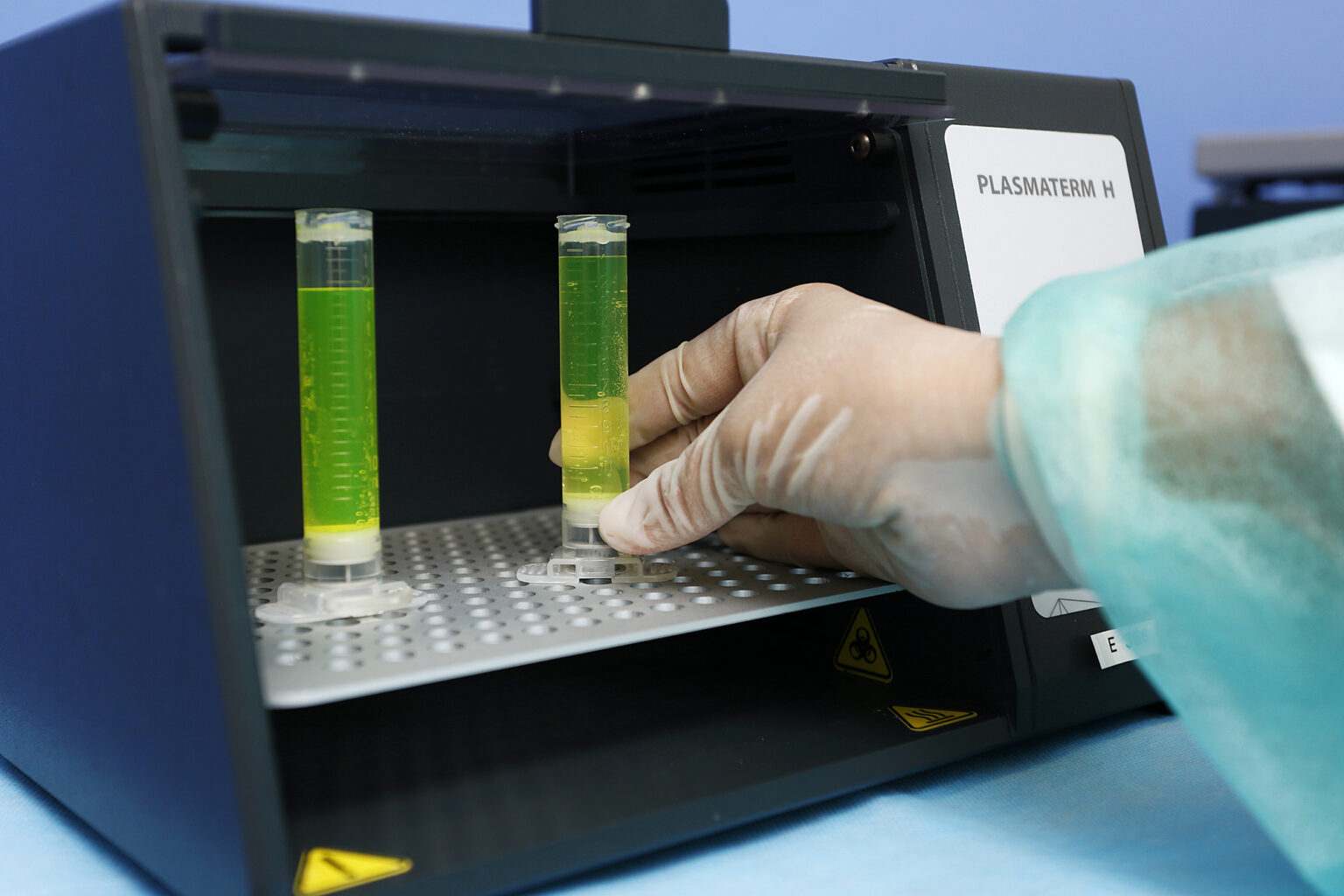 PRGF eye drops - Miranza